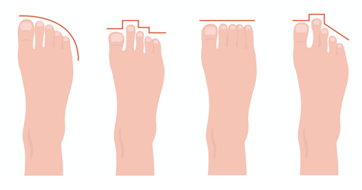 Zjistěte podle tvaru svého chodidla, kým jste | VědaŽivě.cz