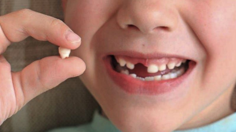 Je tu důvod, proč uchovávat mléčné zuby? | VědaŽivě.cz